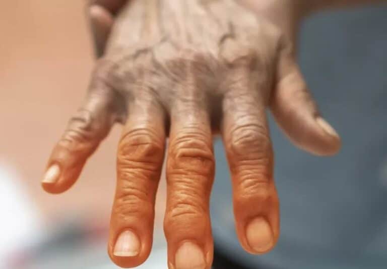 16644_ner_l – Wellness Gaze