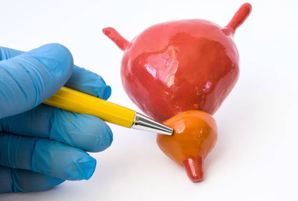 Enlarged Prostate – Is It Dangerous? – Wellness Gaze
