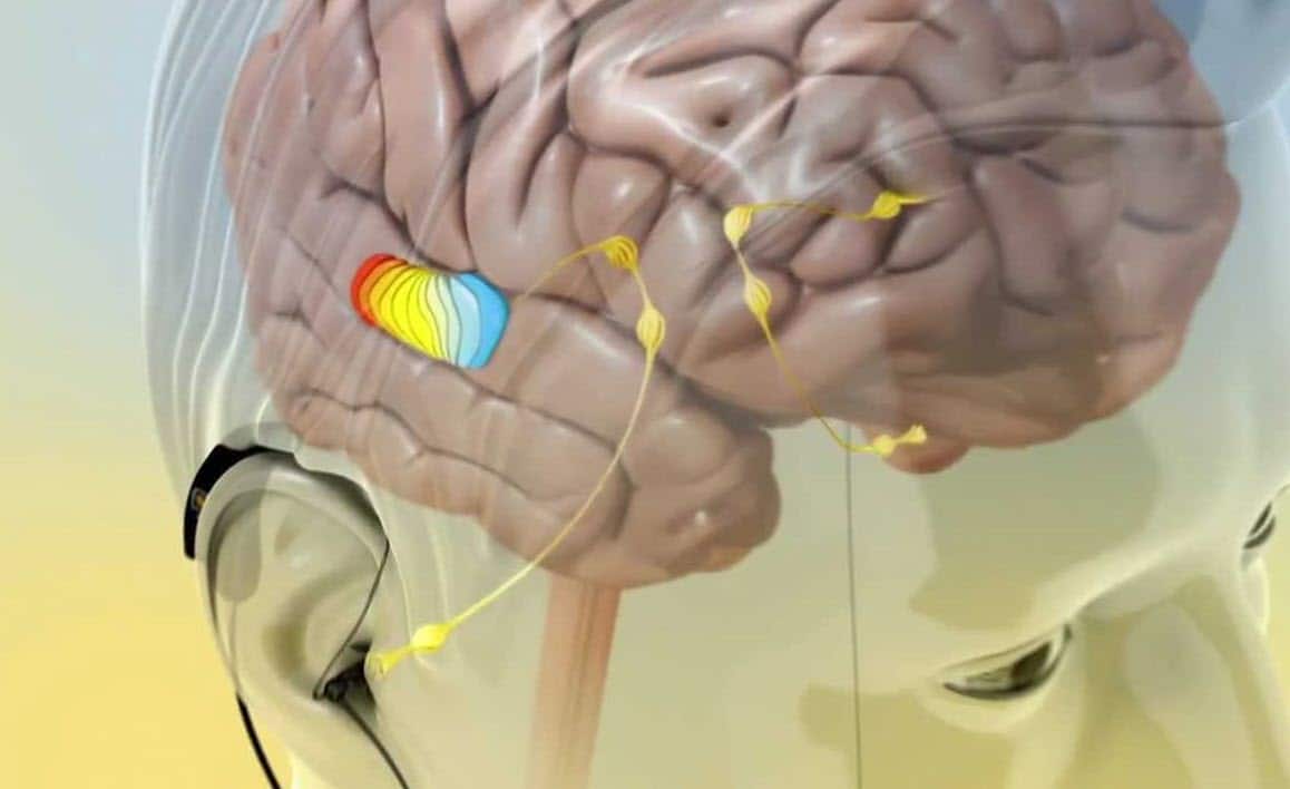 Is Tinnitus Permanent or is There Hope for Sufferers? – Wellness Gaze