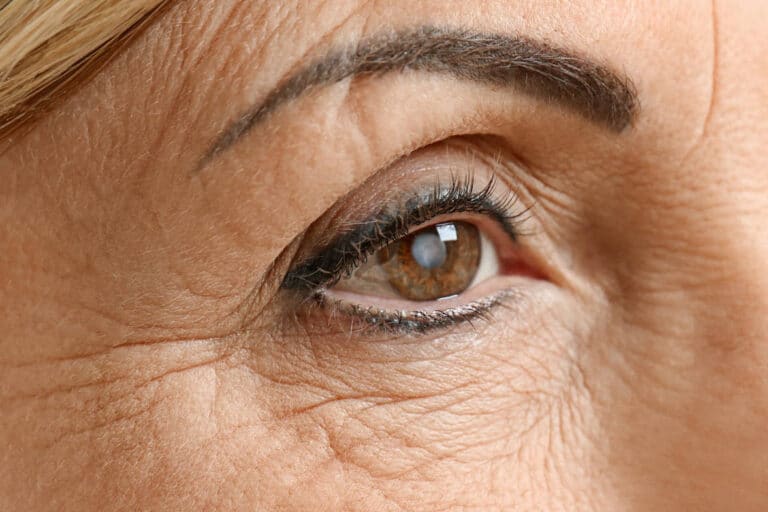 10 Surprising Foods That Could Be Causing Your Macular Degeneration 10 Surprising Foods That Could Be Causing Your Macular Degeneration