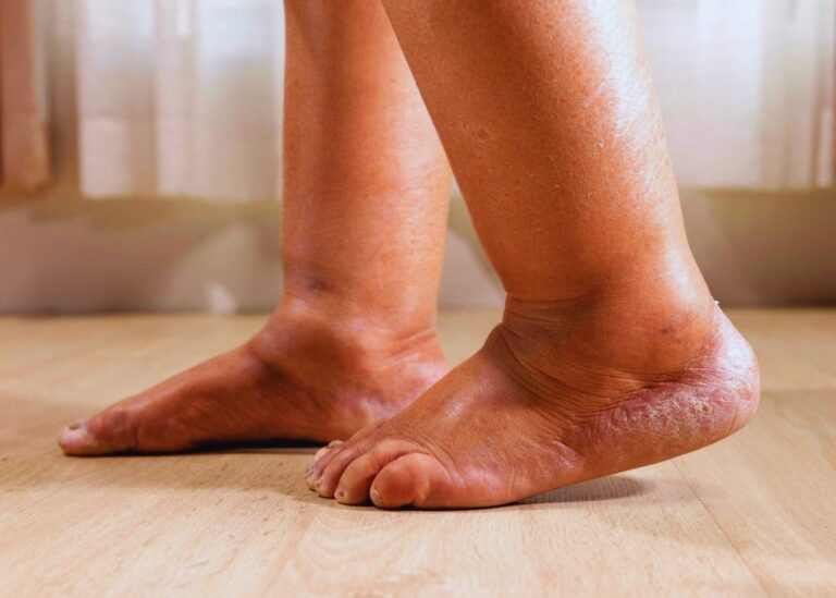 17+ Ingenious Life Hacks To Boost Your Quality Of Life! – Wellness Gaze